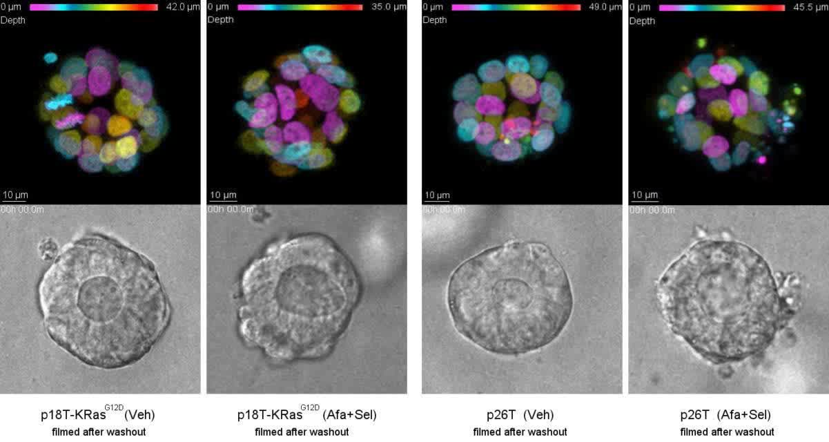 Targeting mutant RAS in patient-derived colorectal cancer organoids by ...